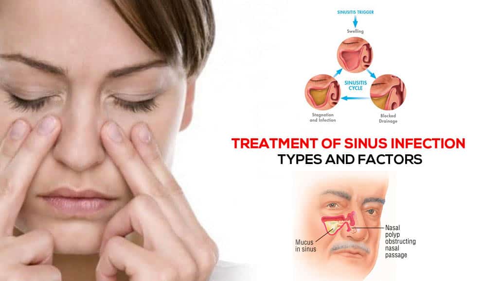 Prevention & Treatment of Sinus infection | Types and Factors - wikiJunkie